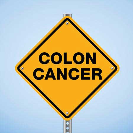 Risk Factors, Symptoms, and Treatments of Colorectal Cancer | Frankfort ...